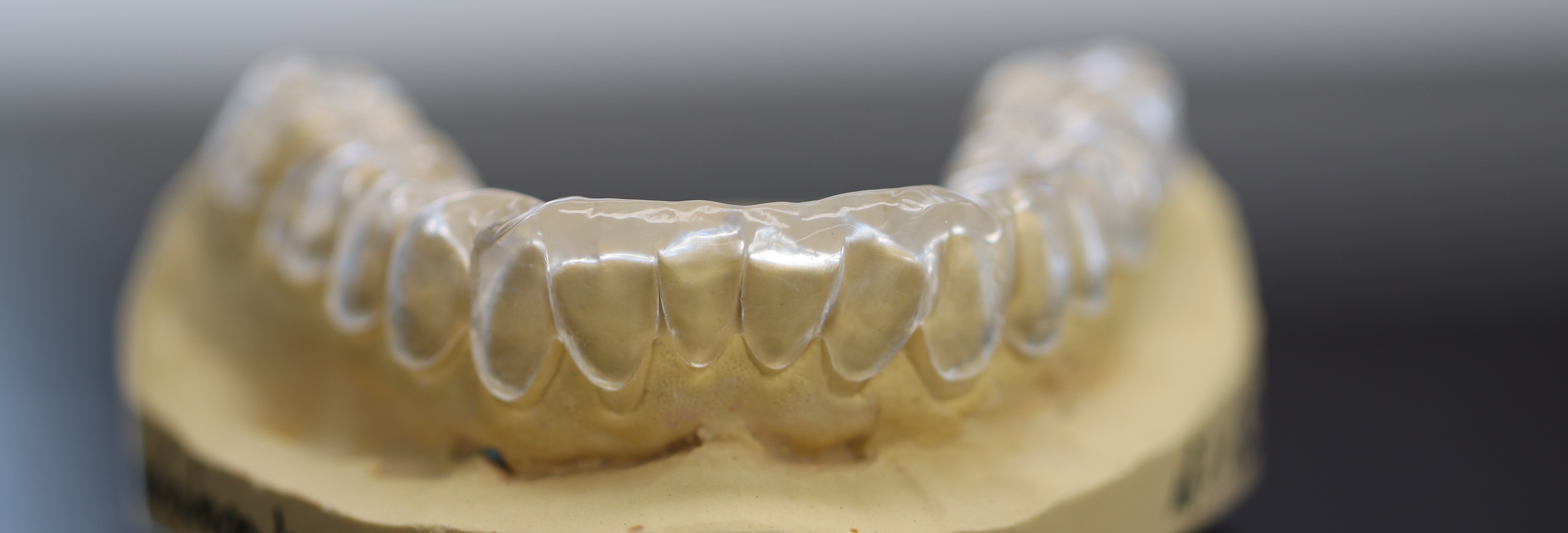 Lipp Zahntechnik - Tiefziehschienen