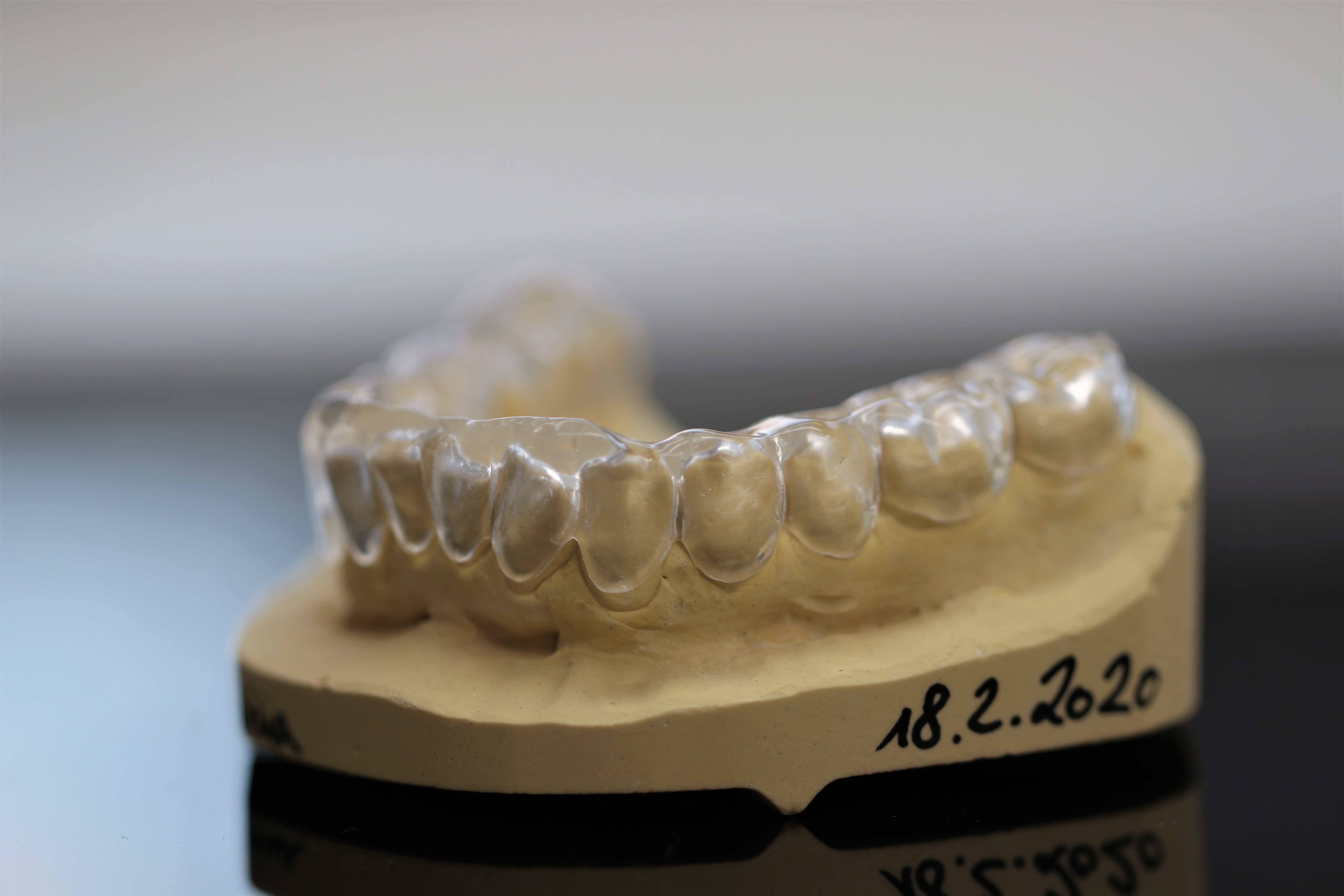 Lipp Zahntechnik - Tiefziehschienen